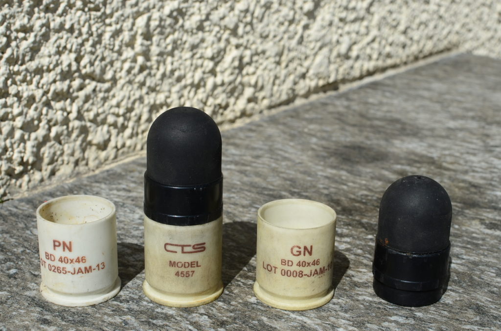 "Mon œil a perdu plus des trois quarts de sa vue" : ils accusent les ...